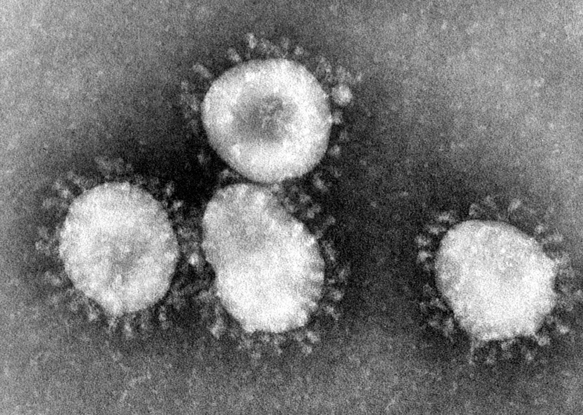 Coronavirus visto desde microscopio - Comprar Microscopios Covid19